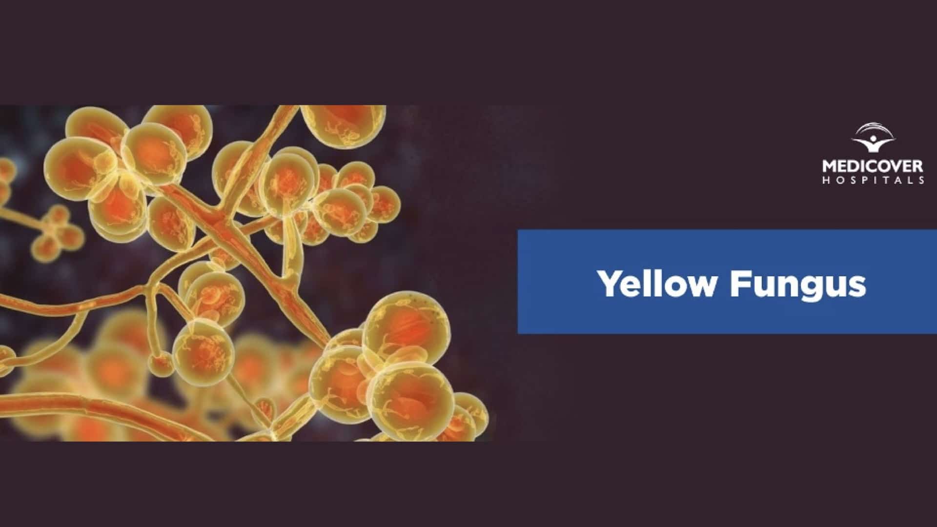 Colors of Rot: Pandemic’s Fungal Turn - positions politics